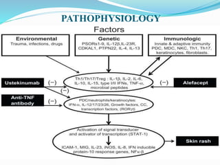 Psoriasis | PPTX