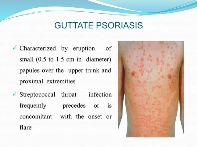 Psoriasis | PPTX | Skin and Dermatology | Diseases and Conditions