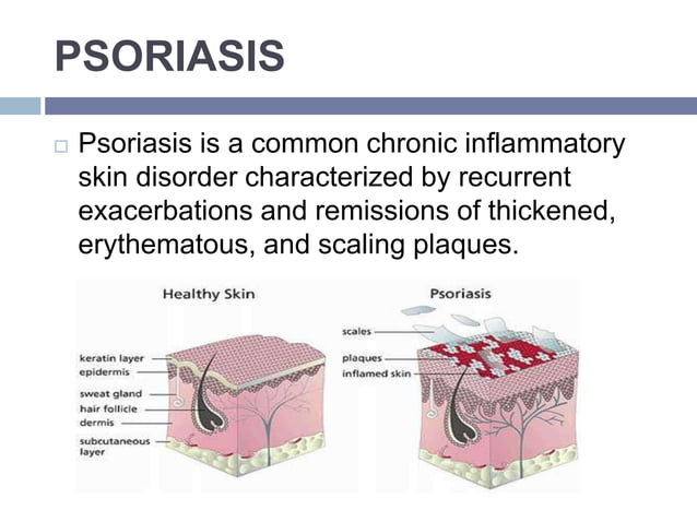 Psoriasis | PPTX | Skin and Dermatology | Diseases and Conditions