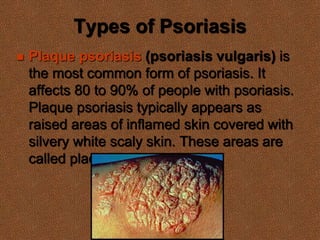 Psoriasis skin disease dermatology | PPT