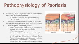 Psoriasis | PPTX