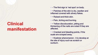 Psoriasis | PPTX