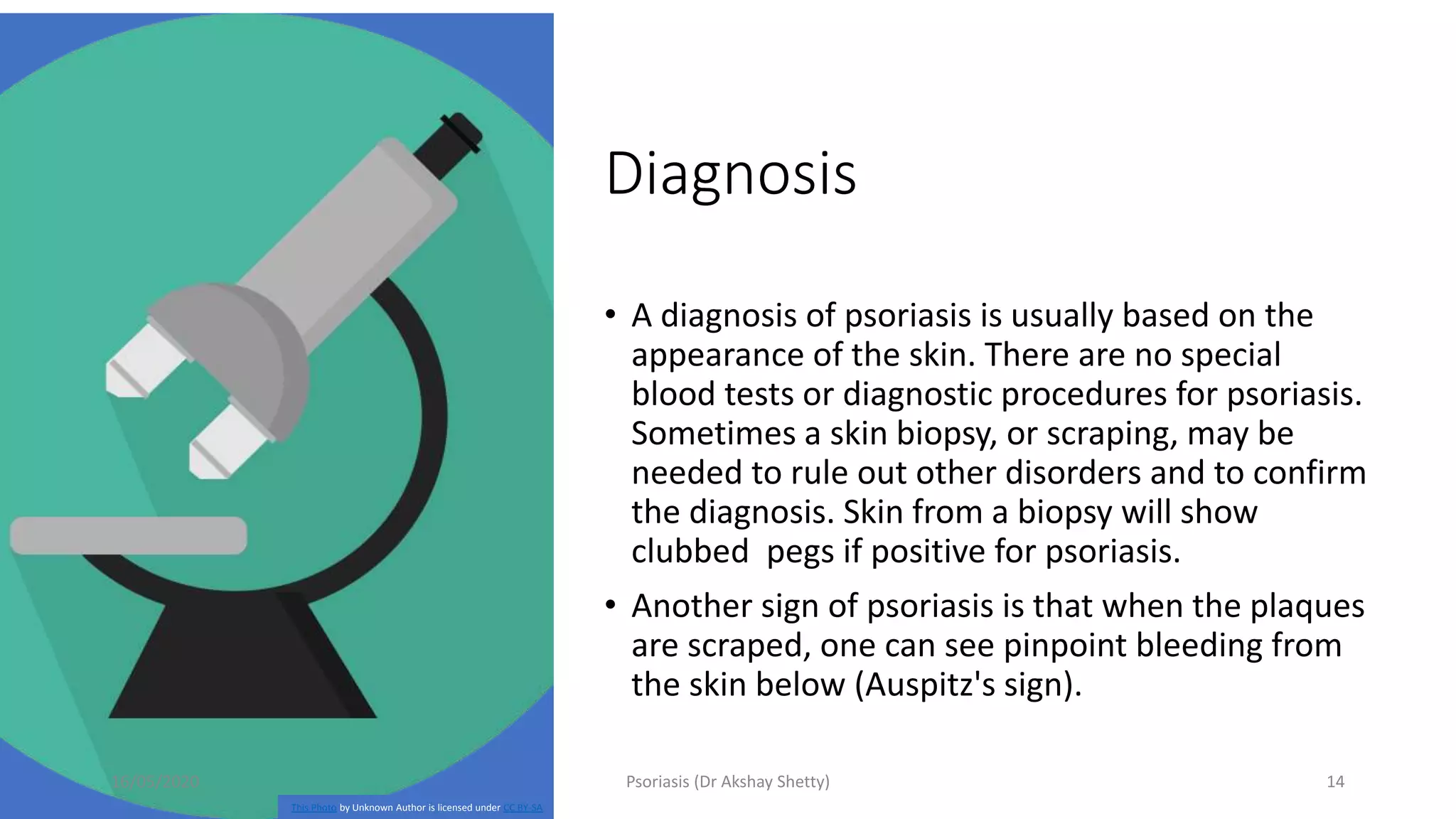 Psoriasis | PPTX