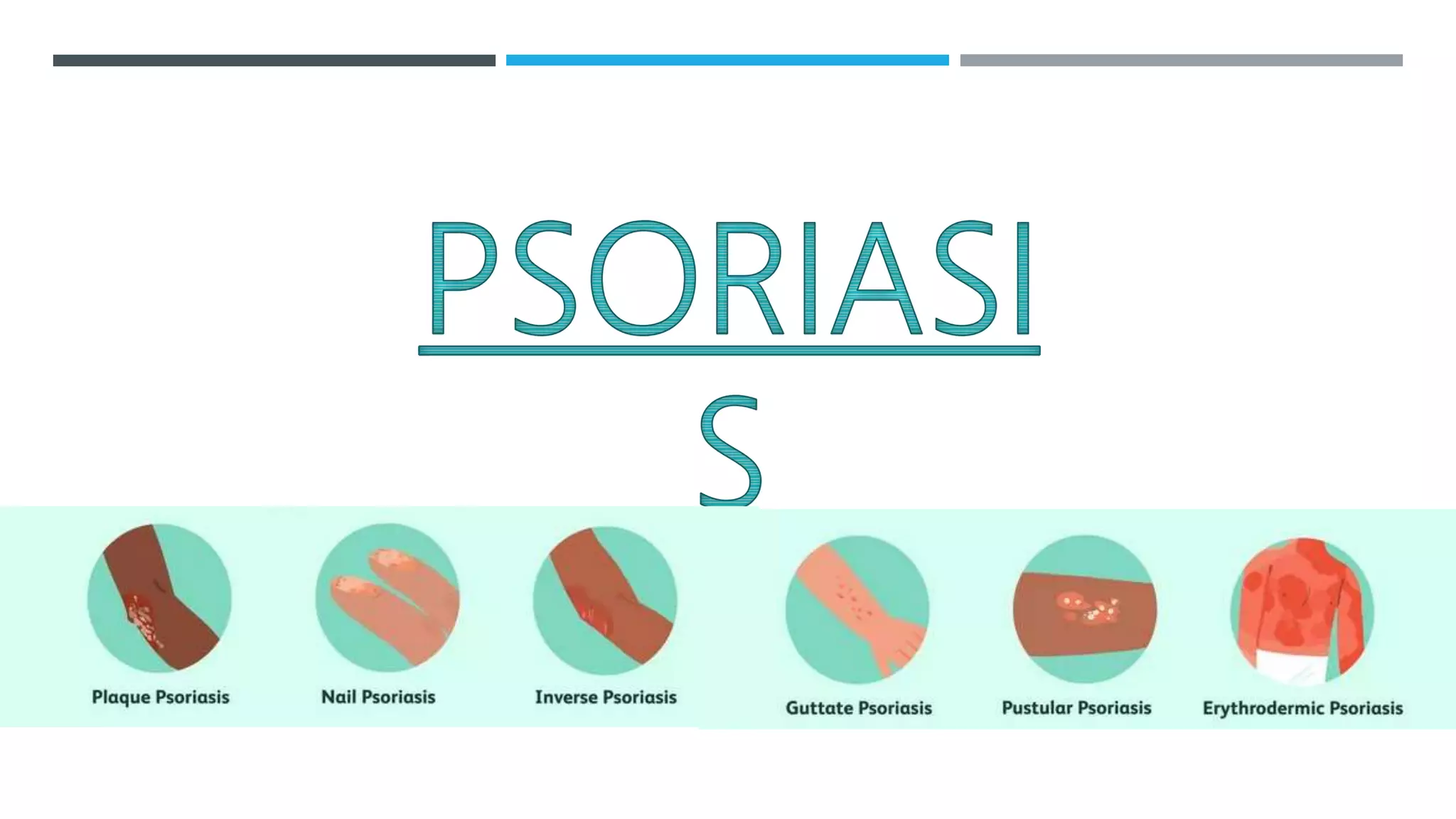 Psoriasis | PPT