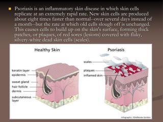 psoriasis.ppt