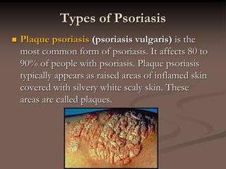 psoriasis.ppt