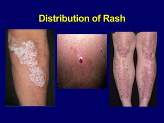 Psoriasis.pdf | Skin and Dermatology | Diseases and Conditions