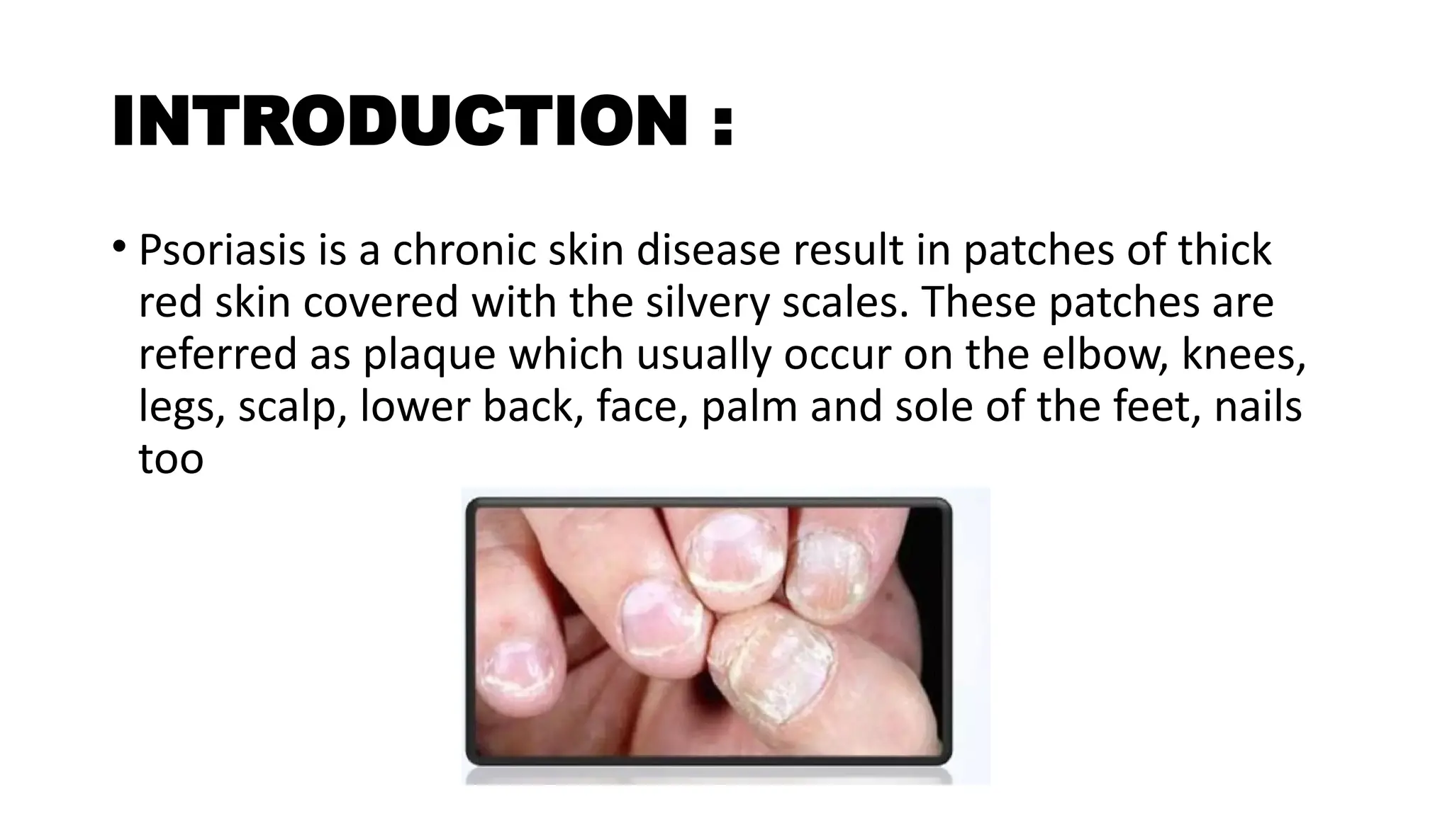 Psoriasis.pptx skin disease bacterial infection | PPTX