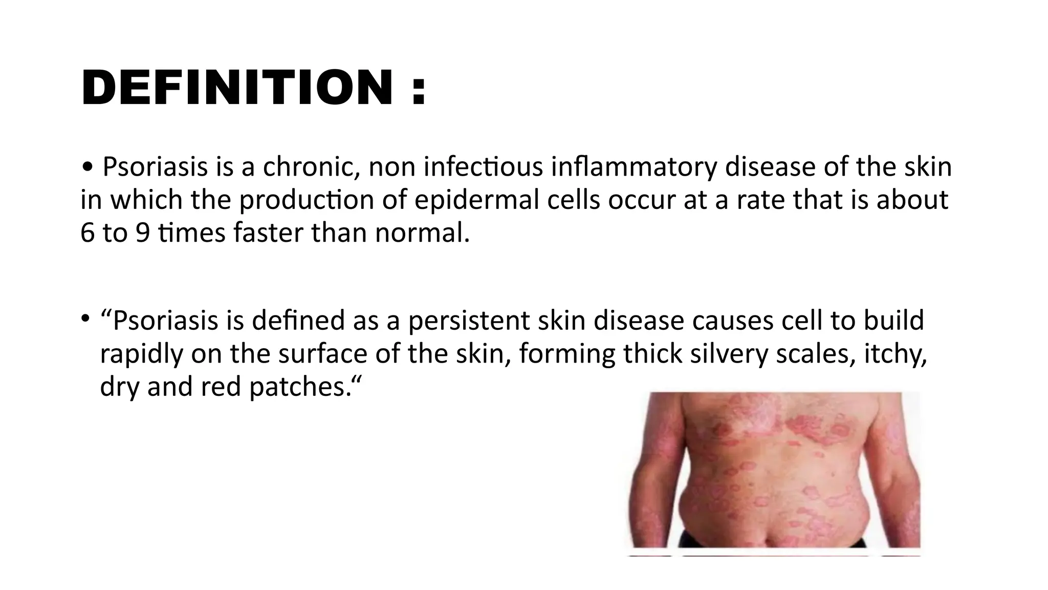 Psoriasis.pptx skin disease bacterial infection | PPTX