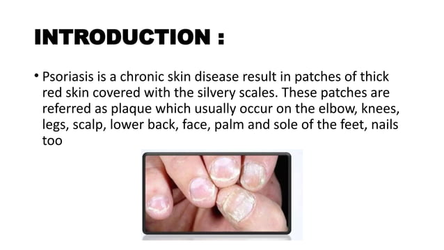 Psoriasis.pptx skin disease bacterial infection | PPT