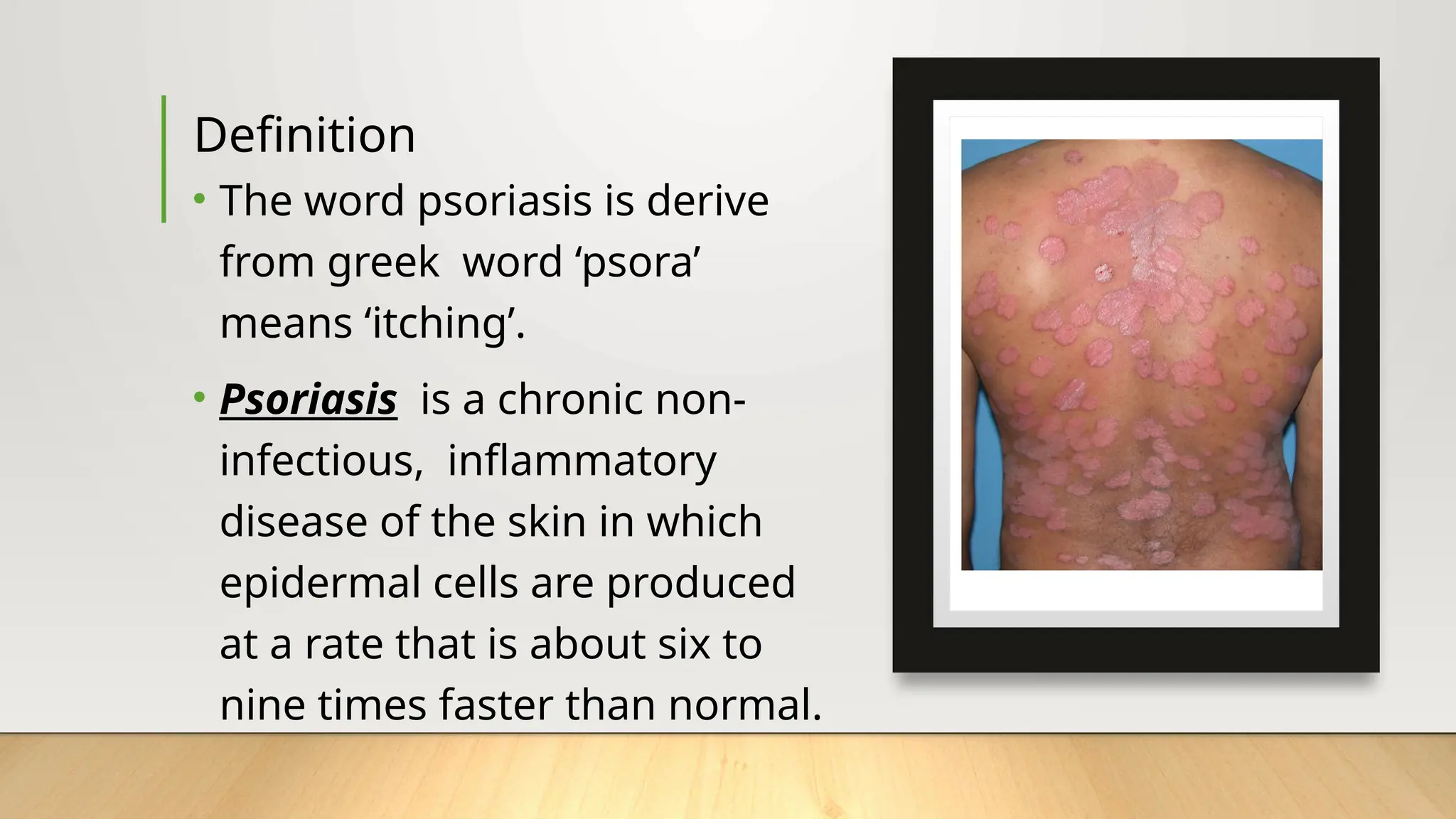 Psoriasis and its management and treatment | PPT