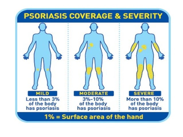 PSORIASIS PRESENTATION FOR EDUCATION.pptx | Skin and Dermatology ...