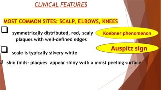 PSORIASIS dermatology slides for medical students | PPTX