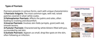 Psoriasis Presentation and Collegeswnote | PPTX