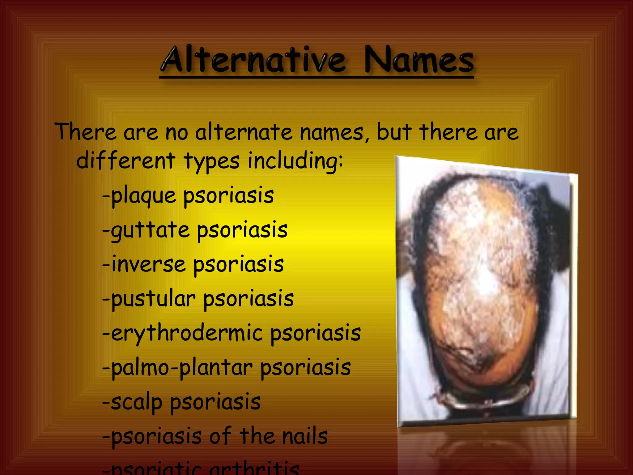 Psoriasis | PPT