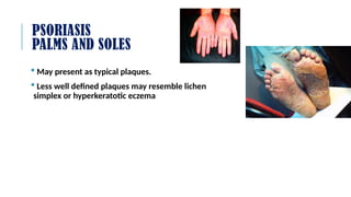 PSORIASIS dermatology slideshow by students | PPTX