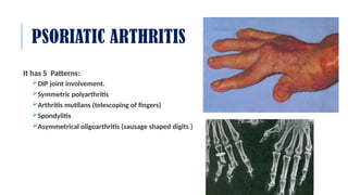 PSORIASIS dermatology slideshow by students | PPTX