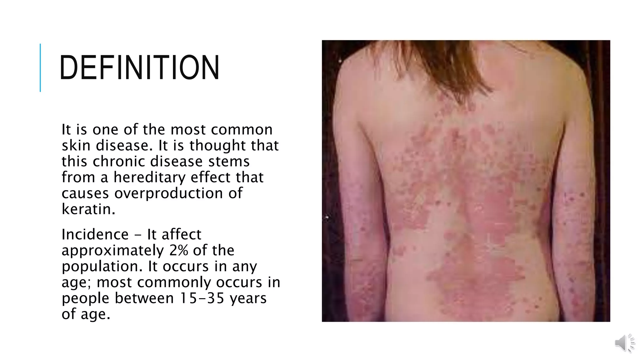 Psoriasis (1).pptx