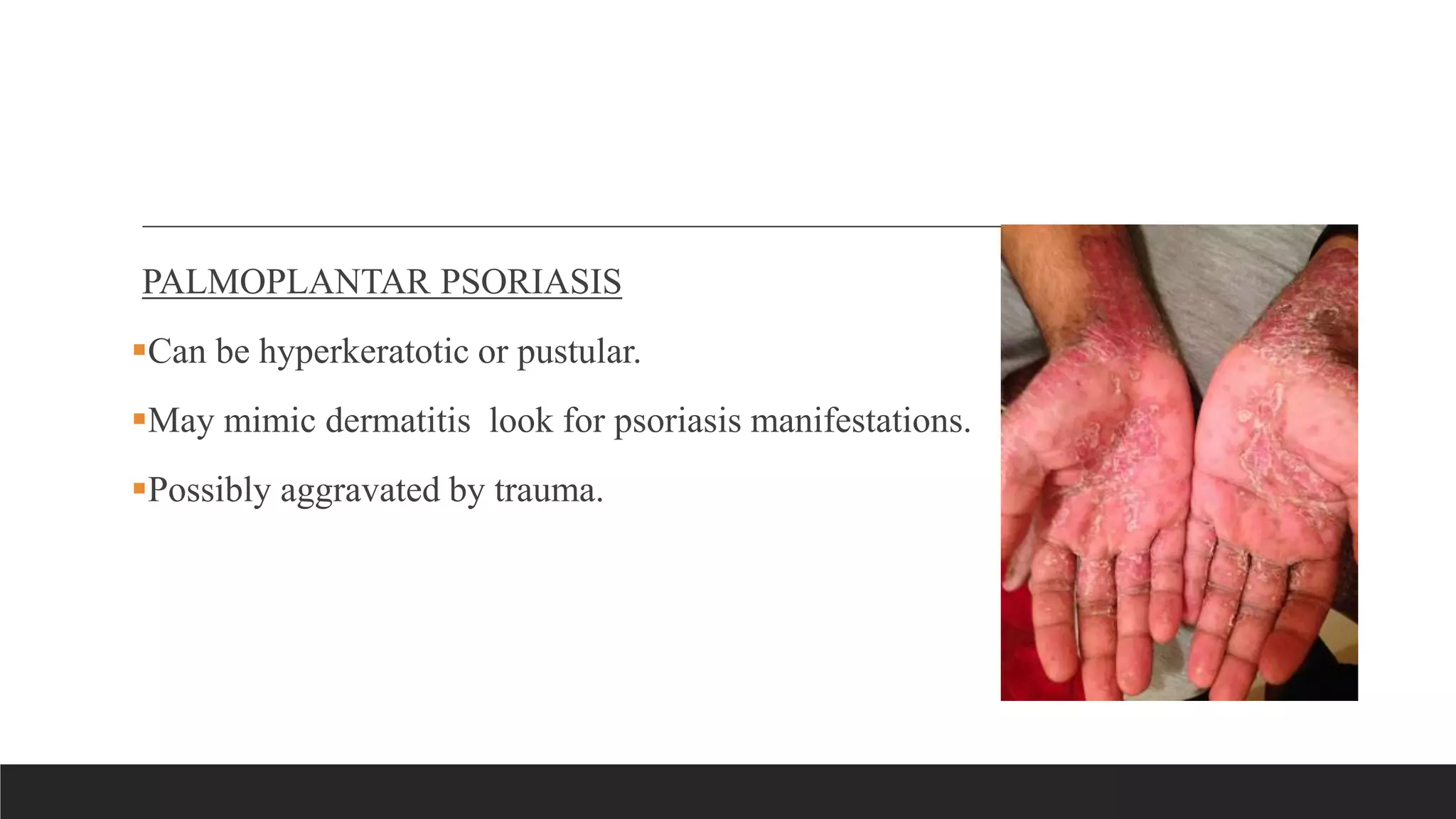 Psoriasis (1).pptx