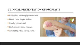 Psoriasis (1).pptx