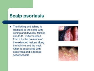 psoriasis1 (2).ppt | Skin and Dermatology | Diseases and Conditions
