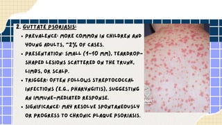Psoriasis examination types ppt presentation | PDF
