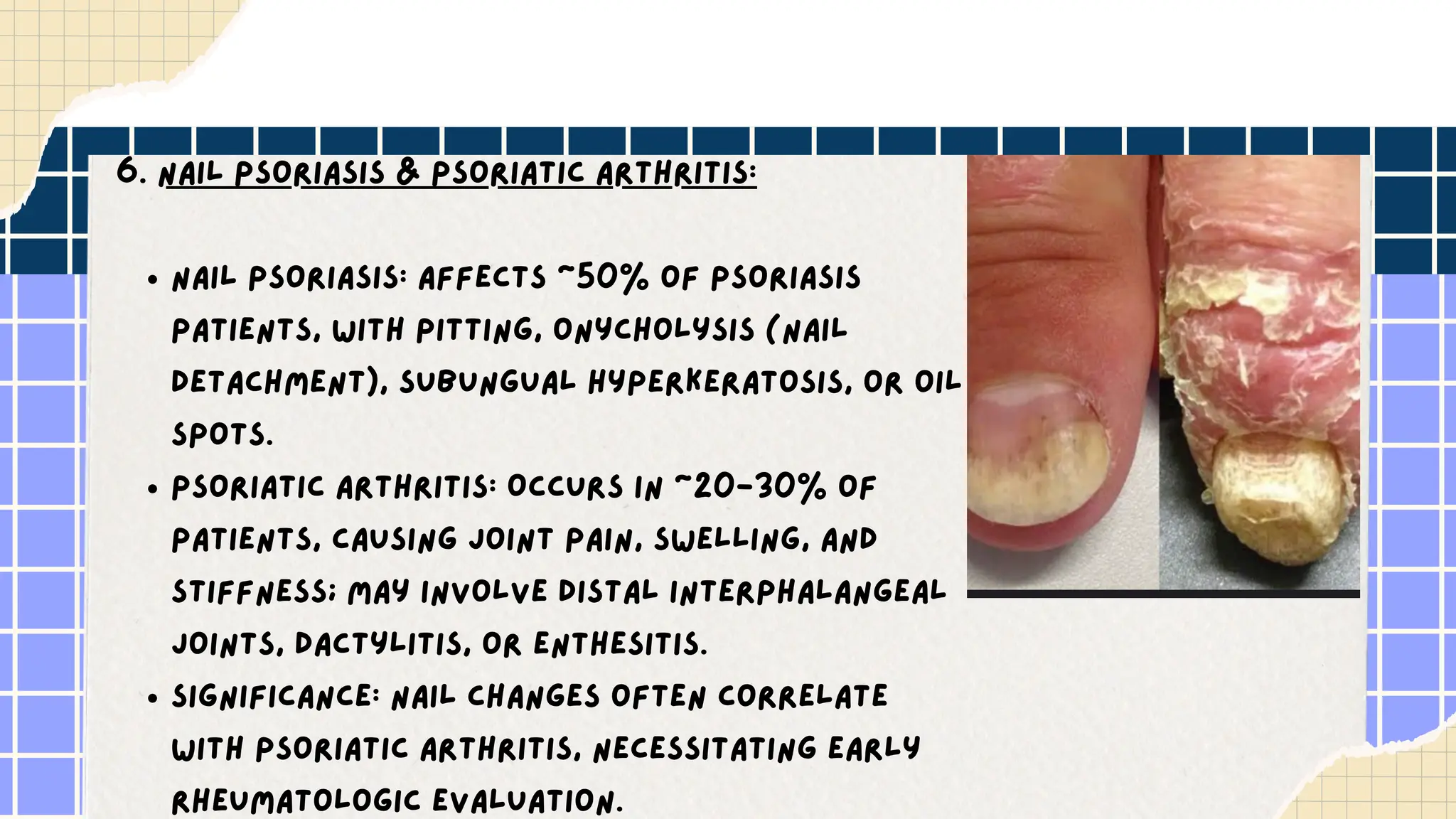 Psoriasis medicine guide and types pdf notes | PDF