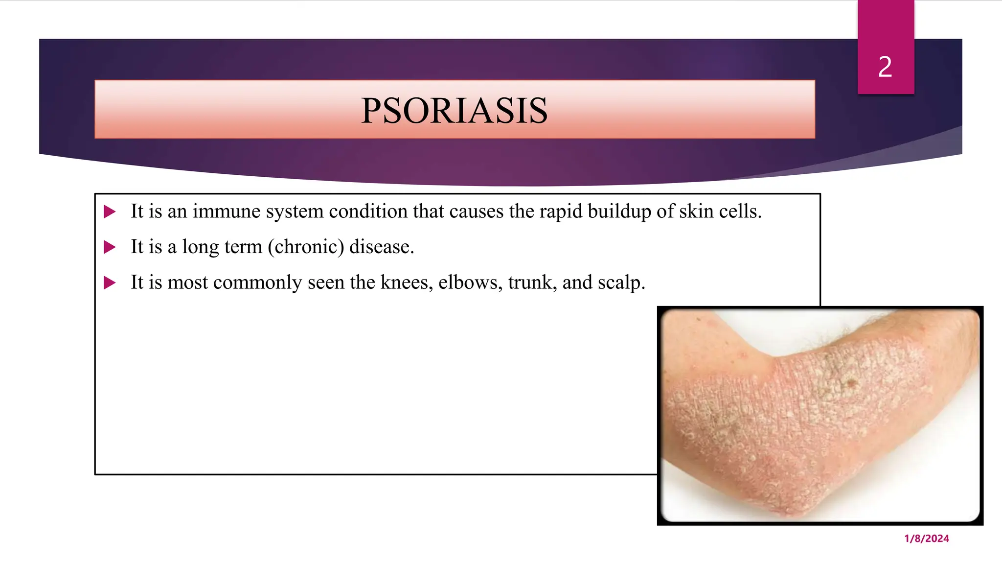 Psoriasis & Acne vulgaris.pptx (Integumentary System) | PPTX
