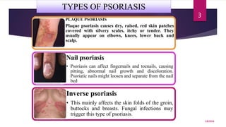 Psoriasis & Acne vulgaris.pptx (Integumentary System) | PPT