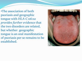 Psoriasis affecting specific sites (2) | PPT