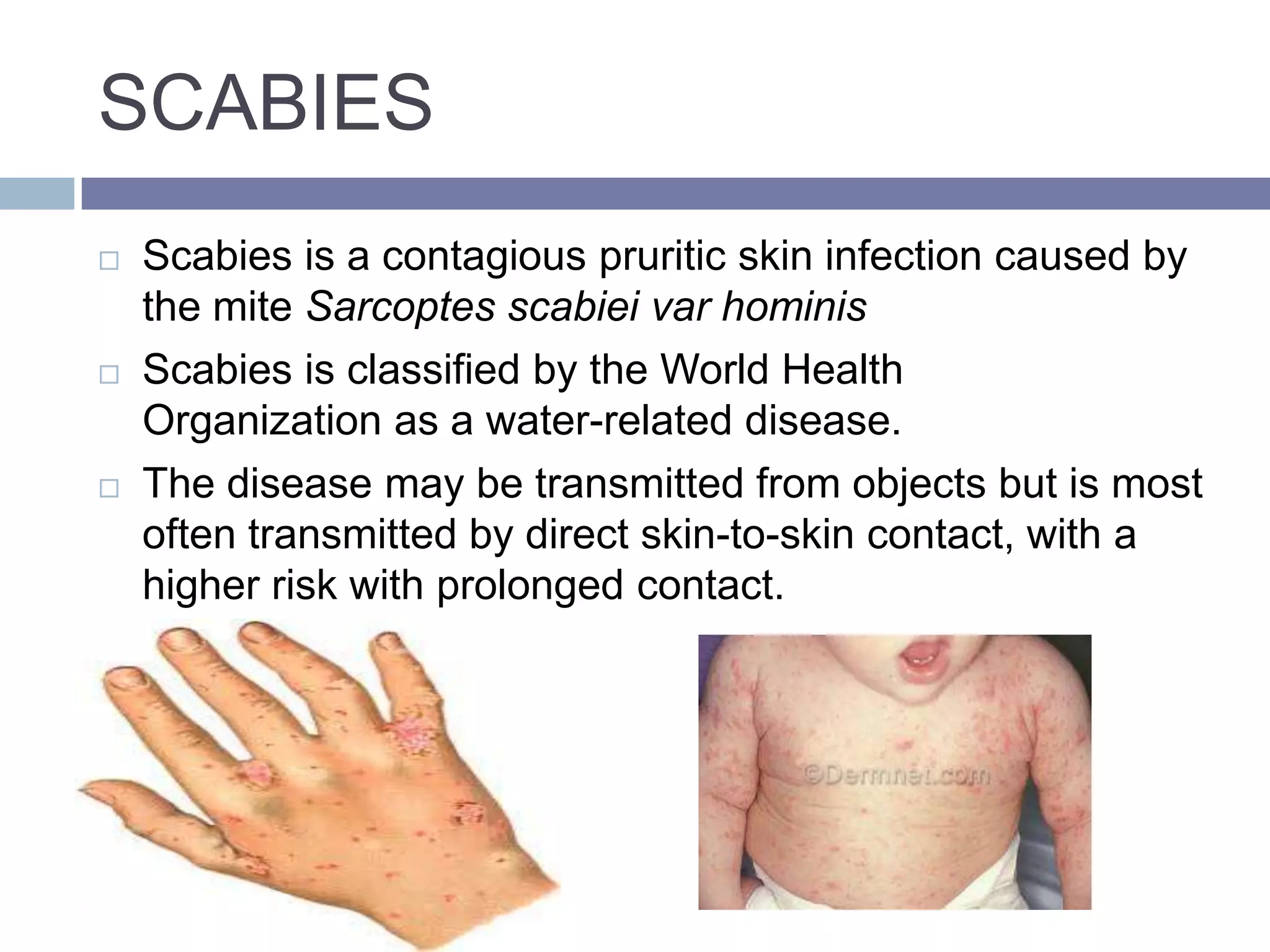 Psoriasis and scabies by manaswi | PPTX