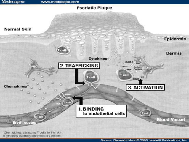 Psoriasis and scabies by manaswi | PPTX | Skin and Dermatology ...