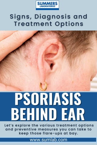 How do you treat psoriasis behind the ear? | PDF