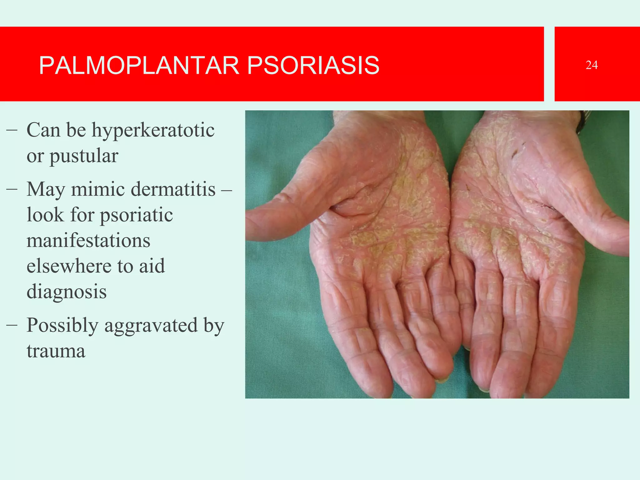 Psoriasis-The best Presentation | PPT