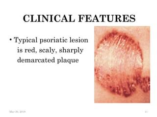 Psoriasis (dermatology) | PPT
