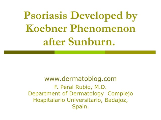 Psoriasis Developed By Koebner Phenomenon After Radiation Therapy | PPT