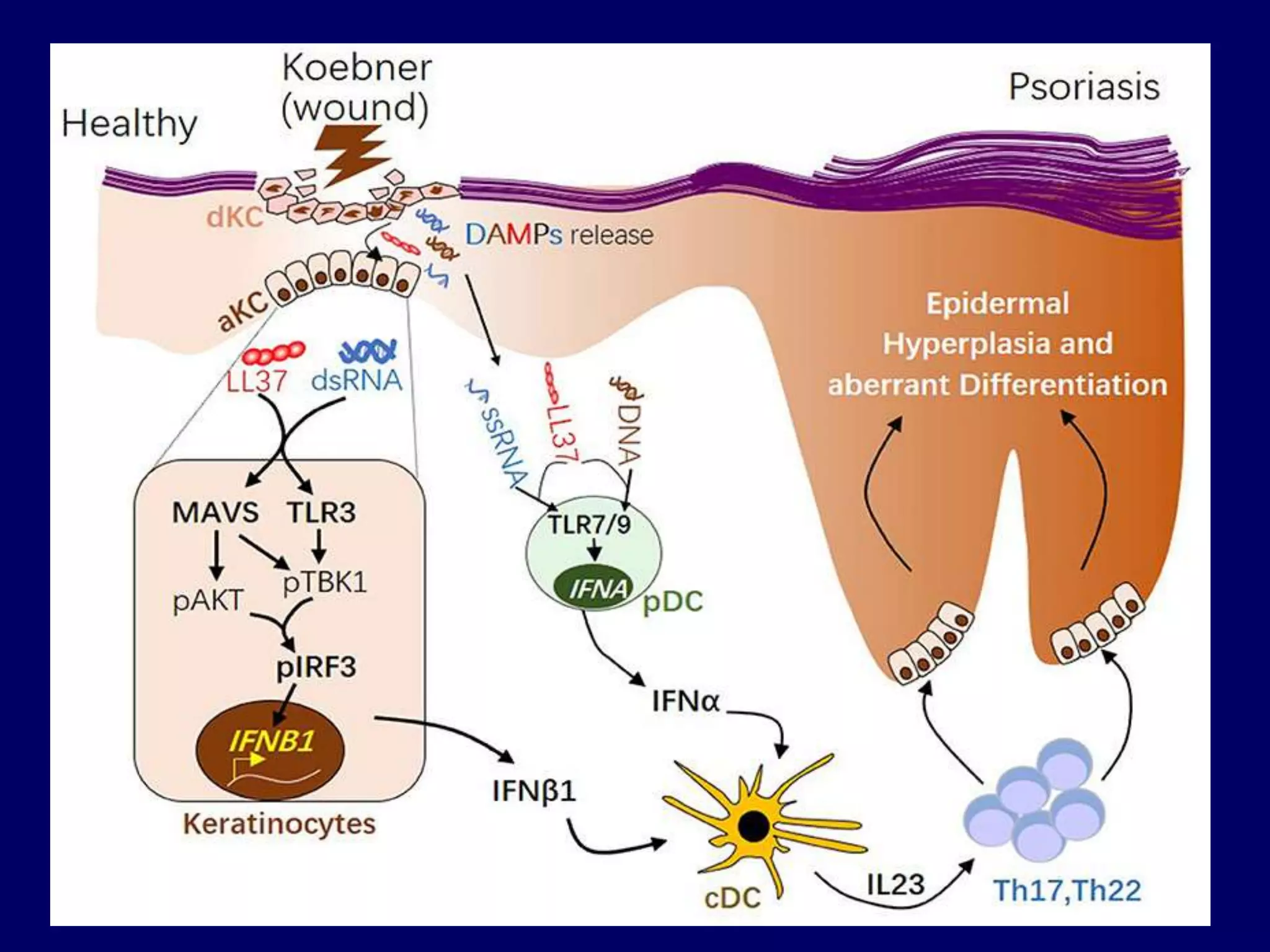 Psoriasis khyzhnyak | PPT
