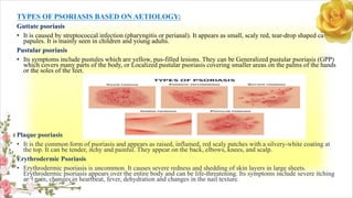 PSORIASIS, MALIGNANT MELANOMA, ALOPECIA.pdf