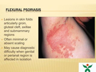 Psoriasis management of ayurveda | PPT