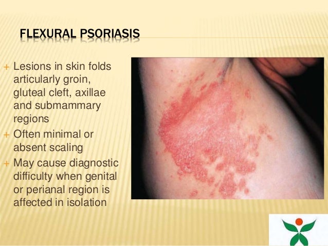 Psoriasis management of ayurveda