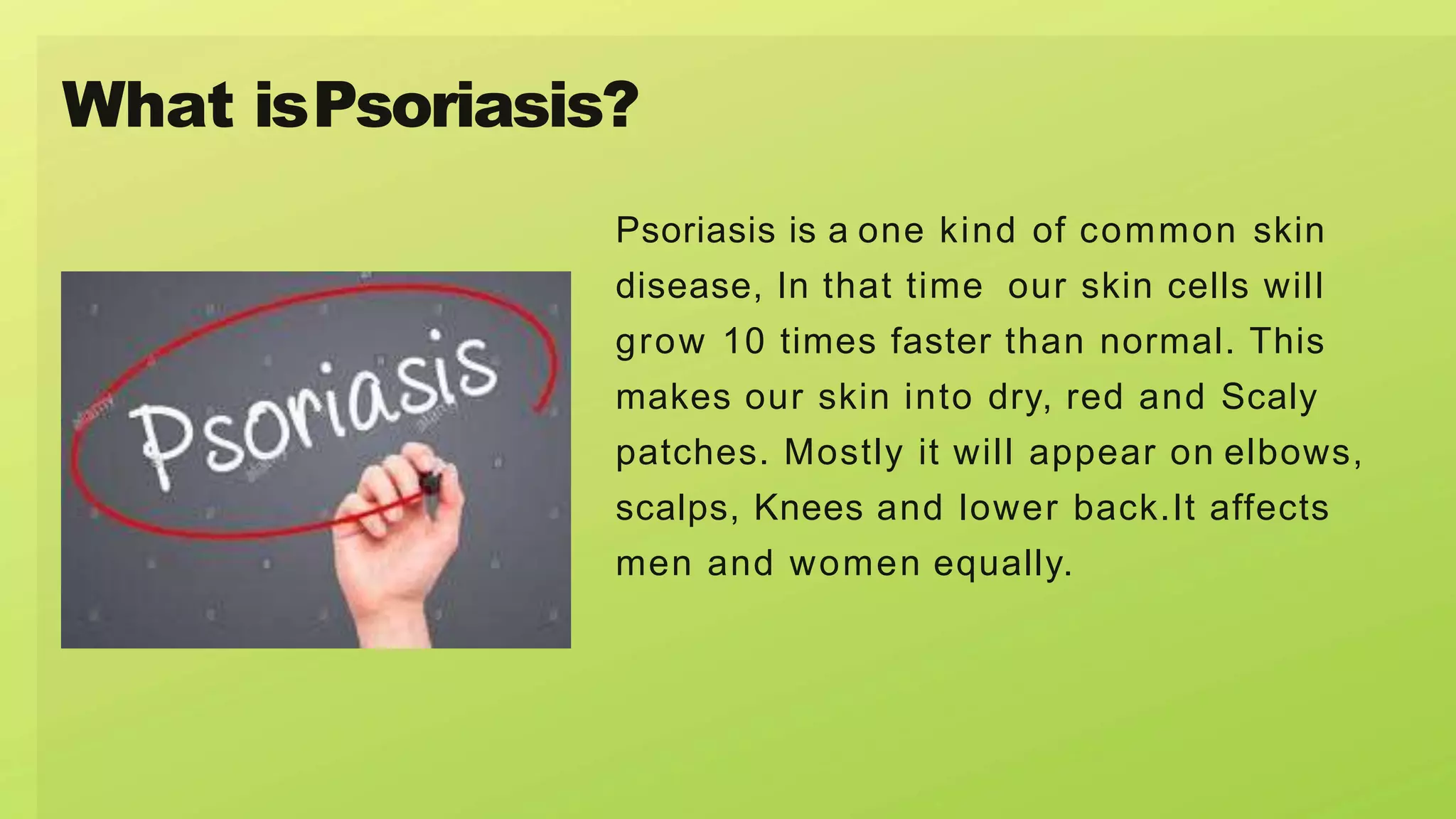 Psoriasis permanently cure with herbal products | PPT