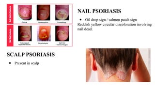 PSORIASIS PowerPoint presentation final derm | PPTX