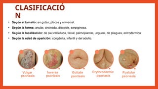 DERMATOLOGIA - PSORIASIS presentacion ppt.pptx