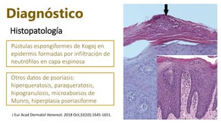 Psoriasis Pustulosa Generalizada | PPTX