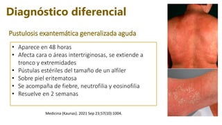 Psoriasis Pustulosa Generalizada | PPTX