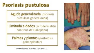 Psoriasis Pustulosa Generalizada | PPTX