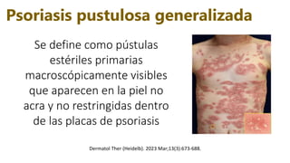Psoriasis Pustulosa Generalizada | PPTX
