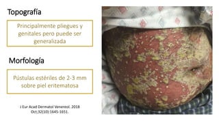 Psoriasis Pustulosa Generalizada | PPTX