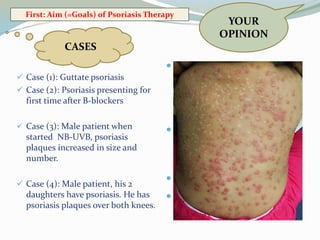 Psoriasis treatment problems in practice | PPTX