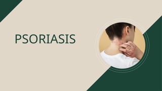 Basics of Psoriasis for Medical Students | PPTX